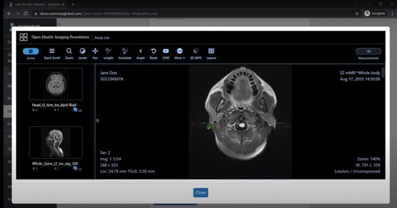 How the "wonderful engineers" at Summus are building the specialist healthcare platform of ...